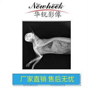 Flat Panel Detectors: The Heart of Modern Digital Imaging